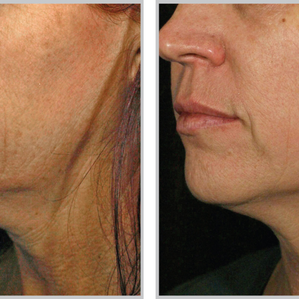 Skin Tyte - Advanced Aesthetics Medical Spa