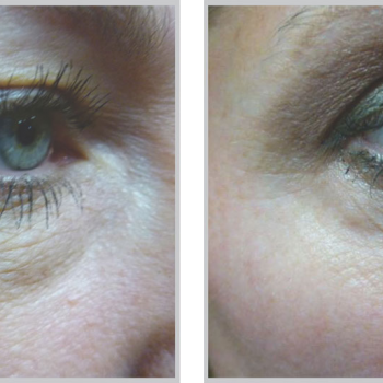 Skin Tyte - Advanced Aesthetics Medical Spa