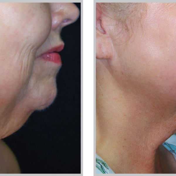 Skin Tyte - Advanced Aesthetics Medical Spa